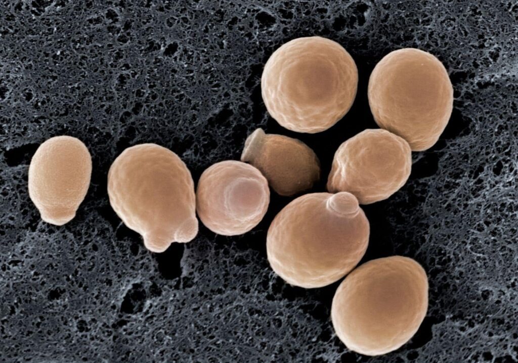 Candida albicans : comprendre cette levure impliquée dans les candidoses